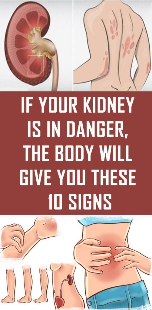 IF YOUR KIDNEY IS IN DANGER, THE BODY WILL GIVE YOU THESE 7 SIGNS