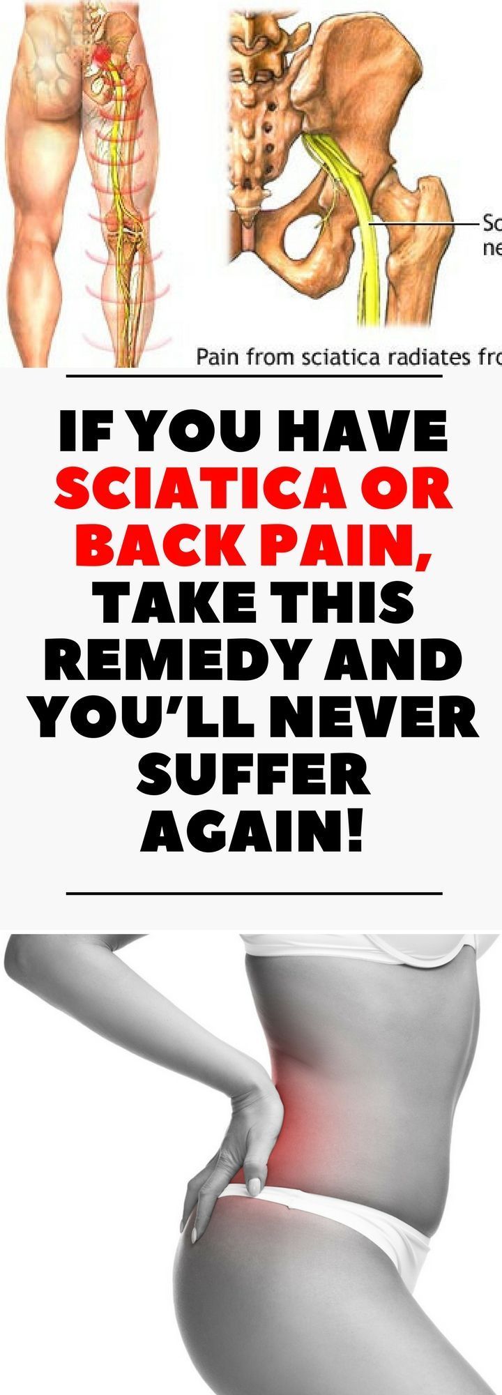 If You Have Sciatica or Back Pain, Take This Remedy and You’ll Never ...