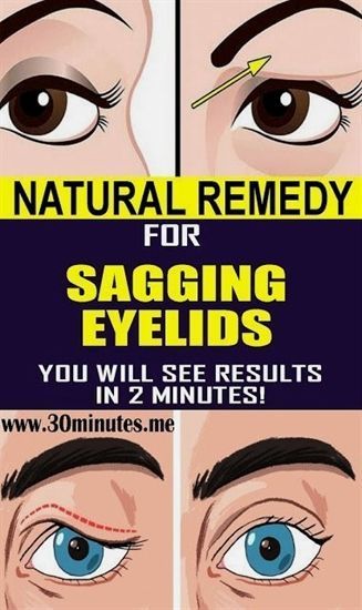 Natural Remedy for Sagging Eyelids – You Will See Results in 2 Minutes!