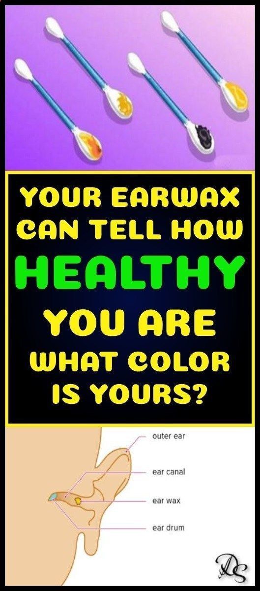 What Earwax Can Tell About Your Health
