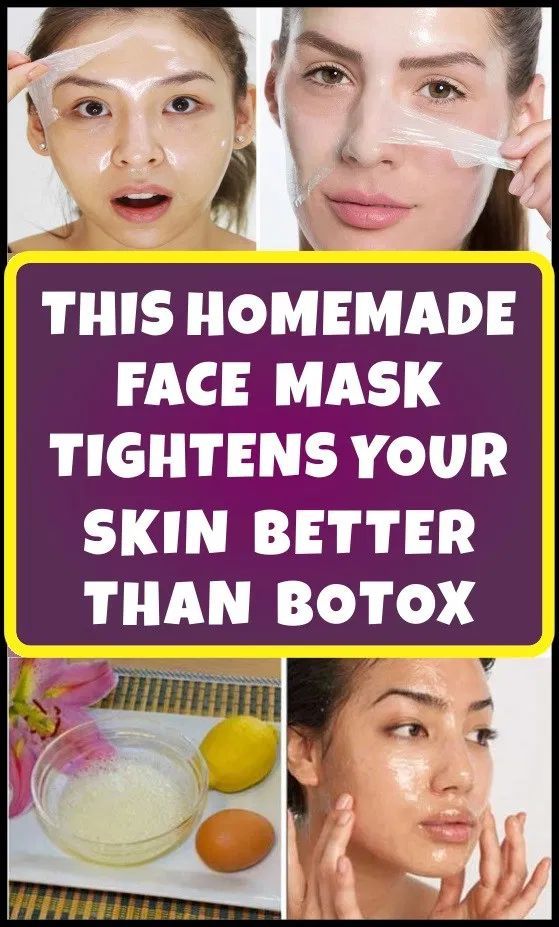 Skin Tightening Homemade Wrinkle Cream That Works Better Than Botox