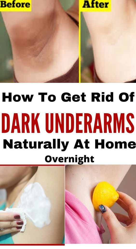 How to Lighten Dark Underarms Fast with 2 Natural Ingredients