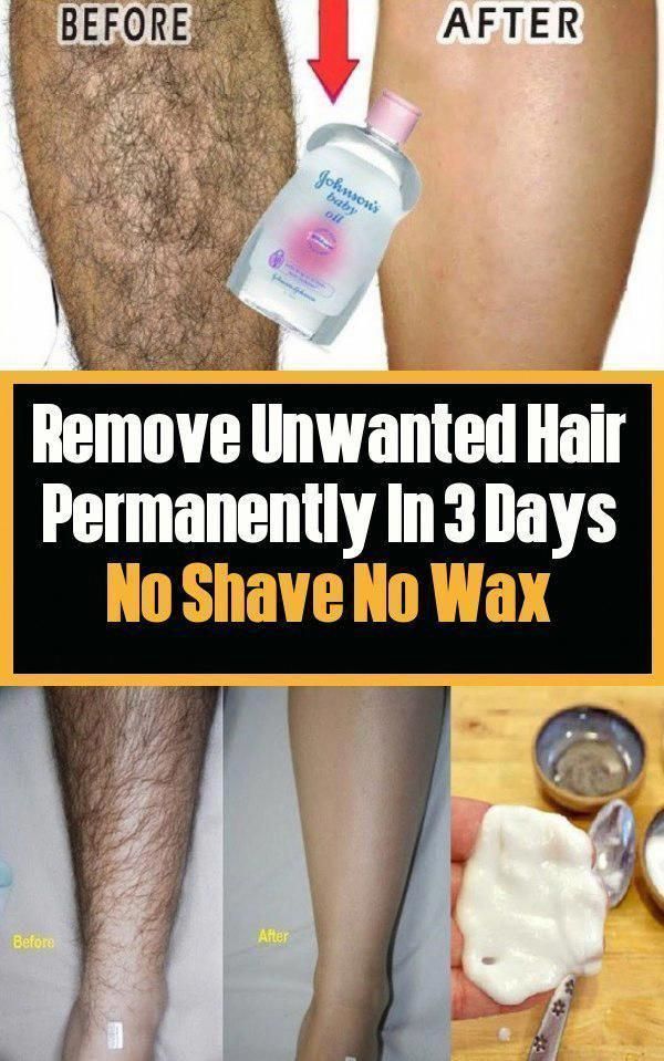 Remove Unwanted Hair Permanently In Three Days No Shave No Wax
