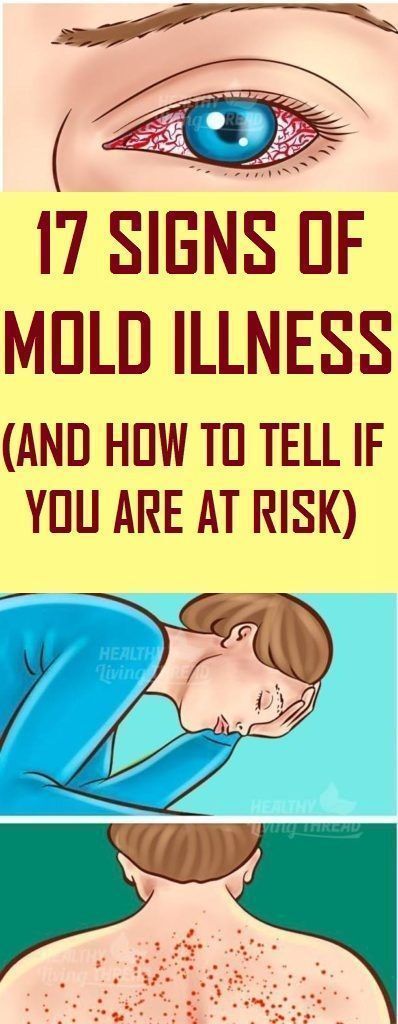 17 Signs of Mold Illness and How to Tell If You Are at Risk