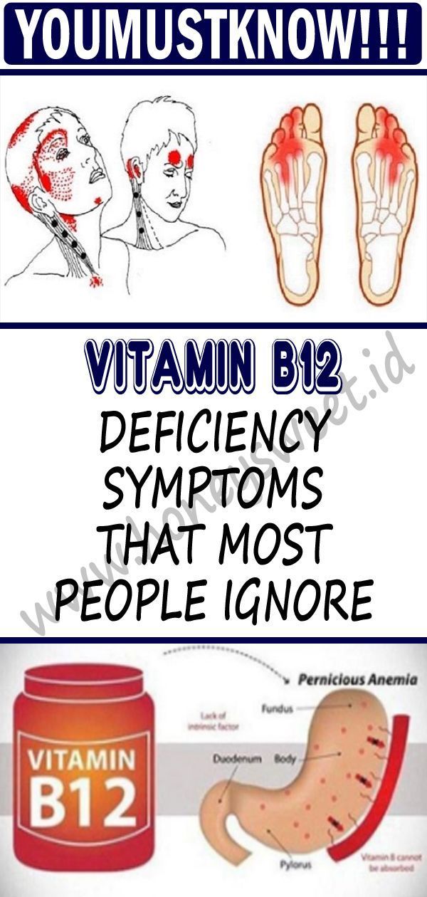Vitamin B12 Deficiency Symptoms That Most People Ignore 9461