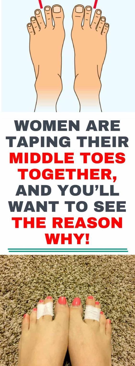 So Many Women Are Taping Their Middle Toes Together, And You’ll Want To ...