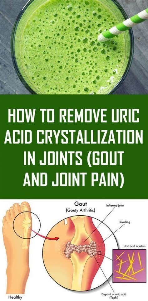 Natural Recipe For Removing Uric Acid From Your Joints